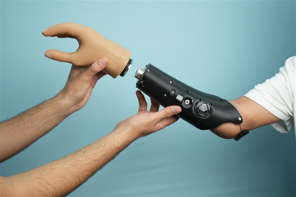 Prosthetics without borders | Zero Project